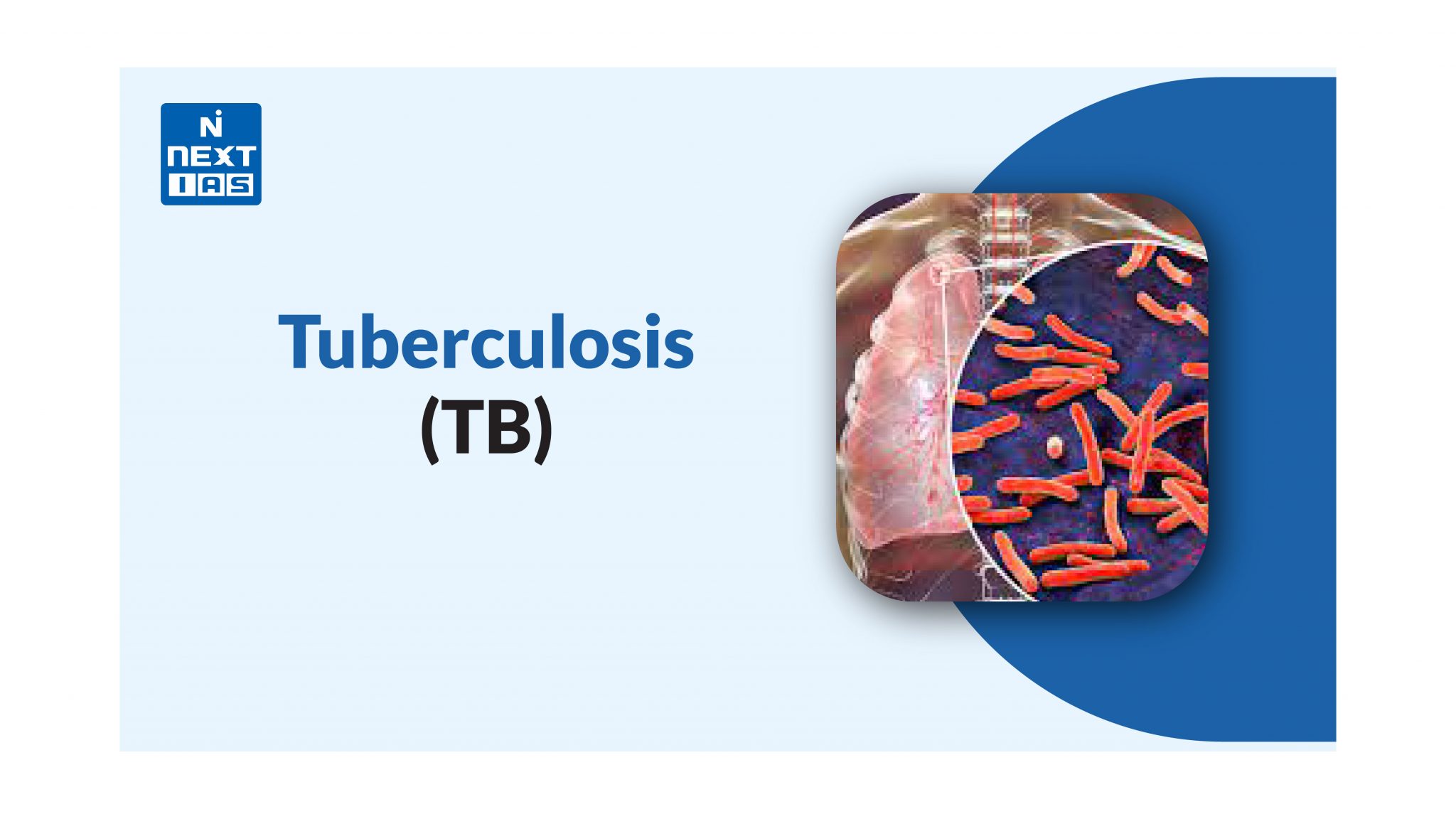 Tuberculosis (TB): Facts, Symptoms, Diagnosis & More