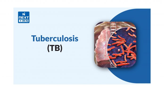 Tuberculosis (TB): Facts, Symptoms, Diagnosis & More